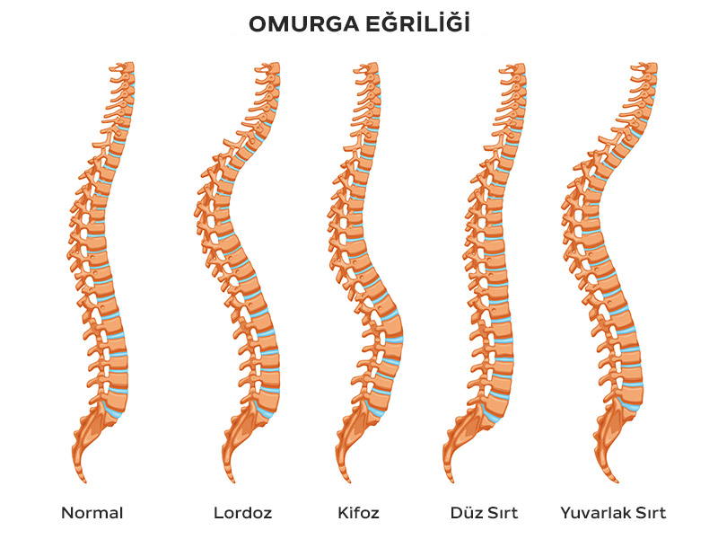 Omurga Eğriliği - Ankara Çocuk Ortopedi ve Travmatoloji Uzmanı